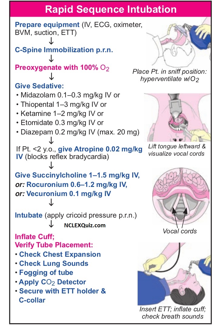 Rapid Sequence Intubation Algorithm NCLEX Quiz Rapid Sequence Intubation Algorithm NCLEX Quiz