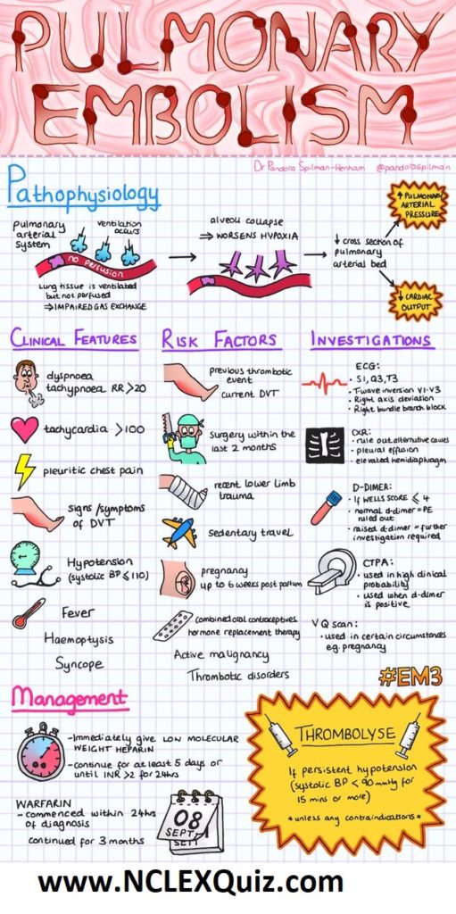 Pulmonary Embolism Pathophysiology Nursing - NCLEX Quiz