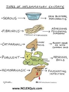 Nursing Study Guide: 5 Types of Inflammatory Exudate - NCLEX Quiz