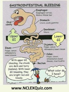 Cheat Sheets Archive - NCLEX Quiz