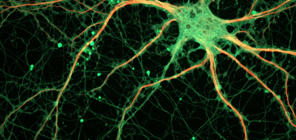 NCLEX Practice Quiz: Anticipated Action of Healthcare Provider for High ...