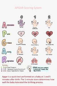 APGAR Score - NCLEX Quiz